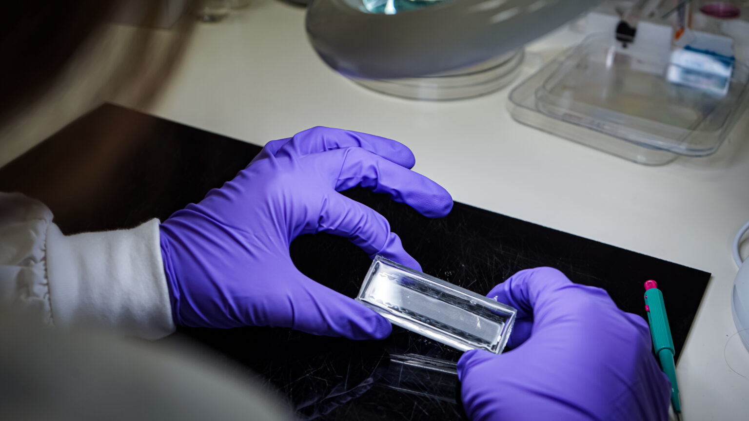 Alexandra Teixeira, developing diagnostic tools tailored for accurate ...